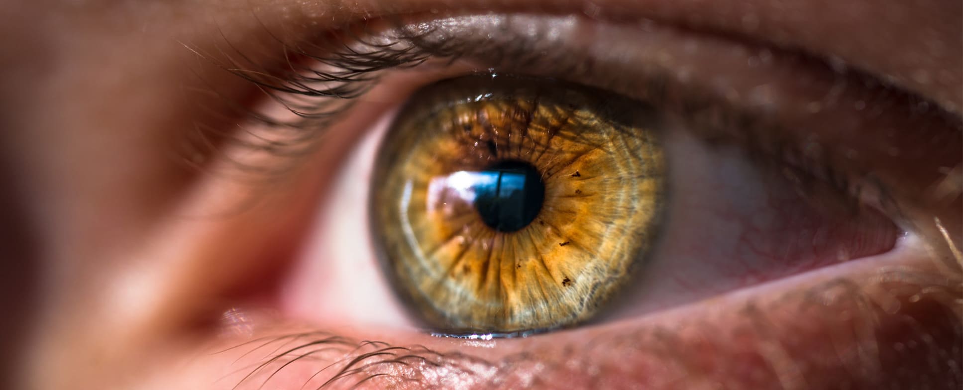 Basic Cataract Surgery - Vistahermosa International